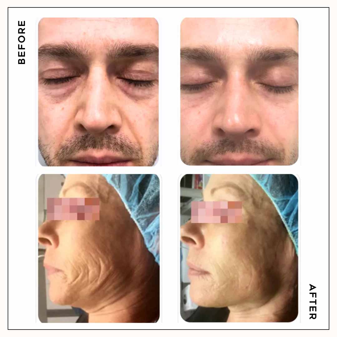 Glo2Facial Lakeway & Austin - Mirabelle Aesthetics & Wellness Clinic