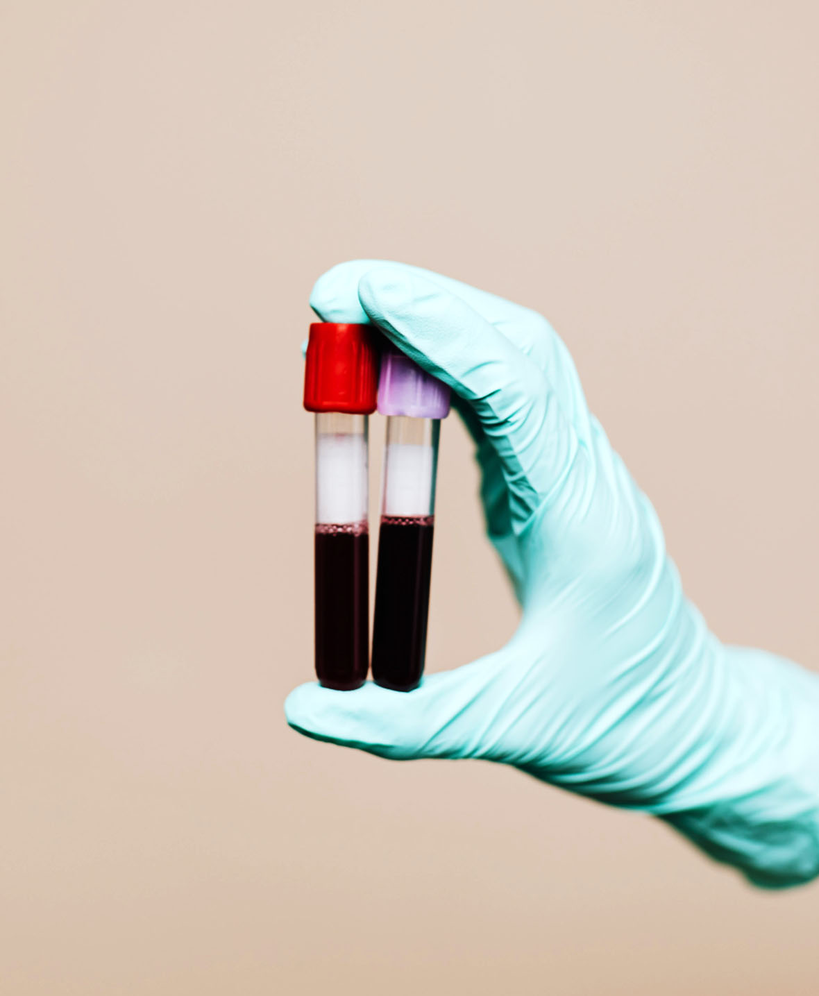 Metabolic Testing at MiraBelle – Mirabelle Aesthetics and Wellness